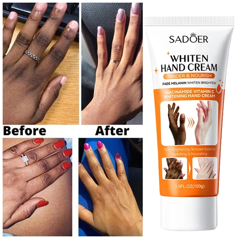 2024 Dark Knuckles Fast Whitening Serum Anti Cracking Cream ...