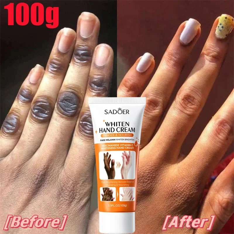 2024 Dark Knuckles Fast Whitening Serum Anti Cracking Cream ...